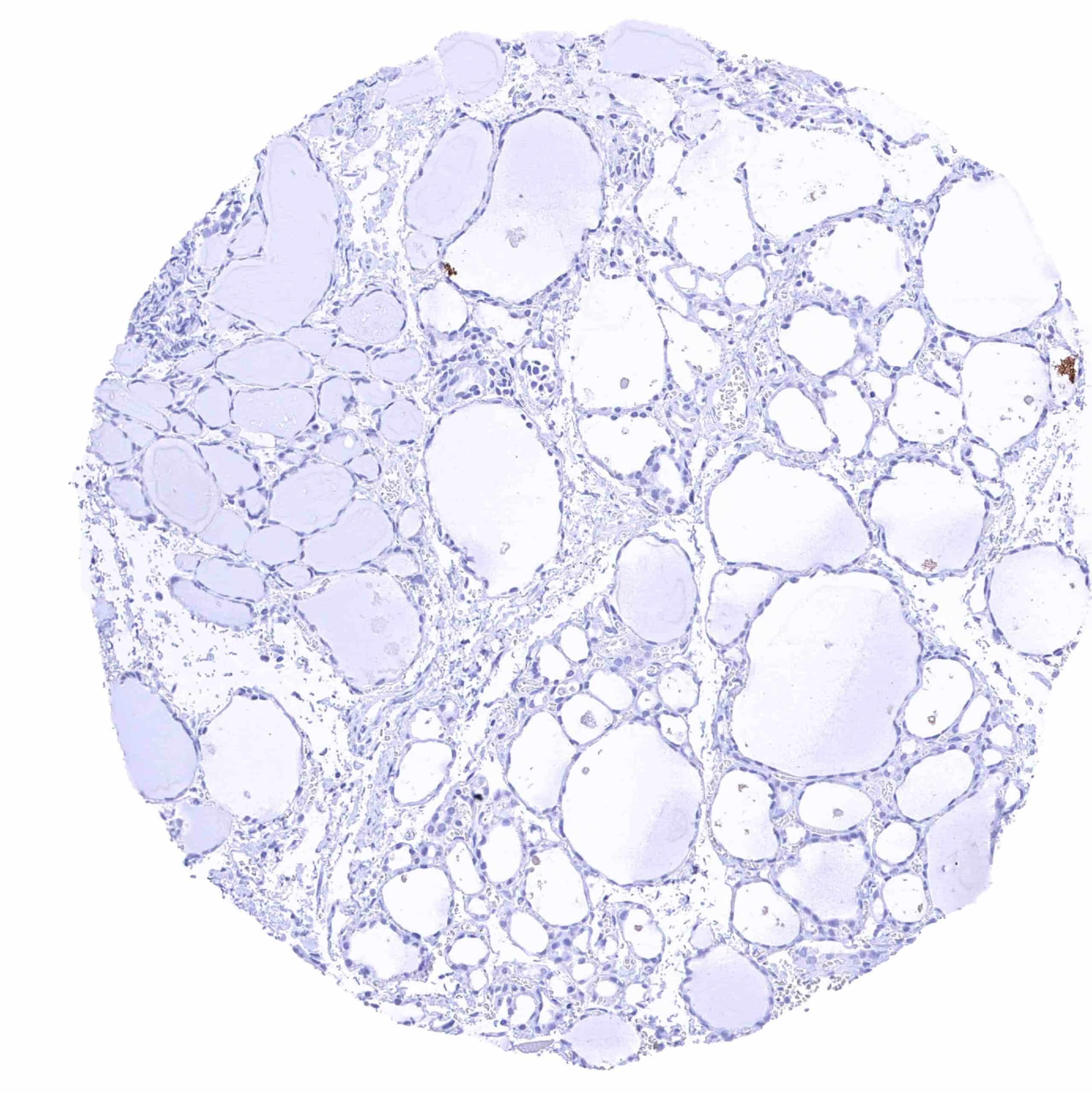 Normal Tissue Gallery Brachyury - MS Validated Antibodies