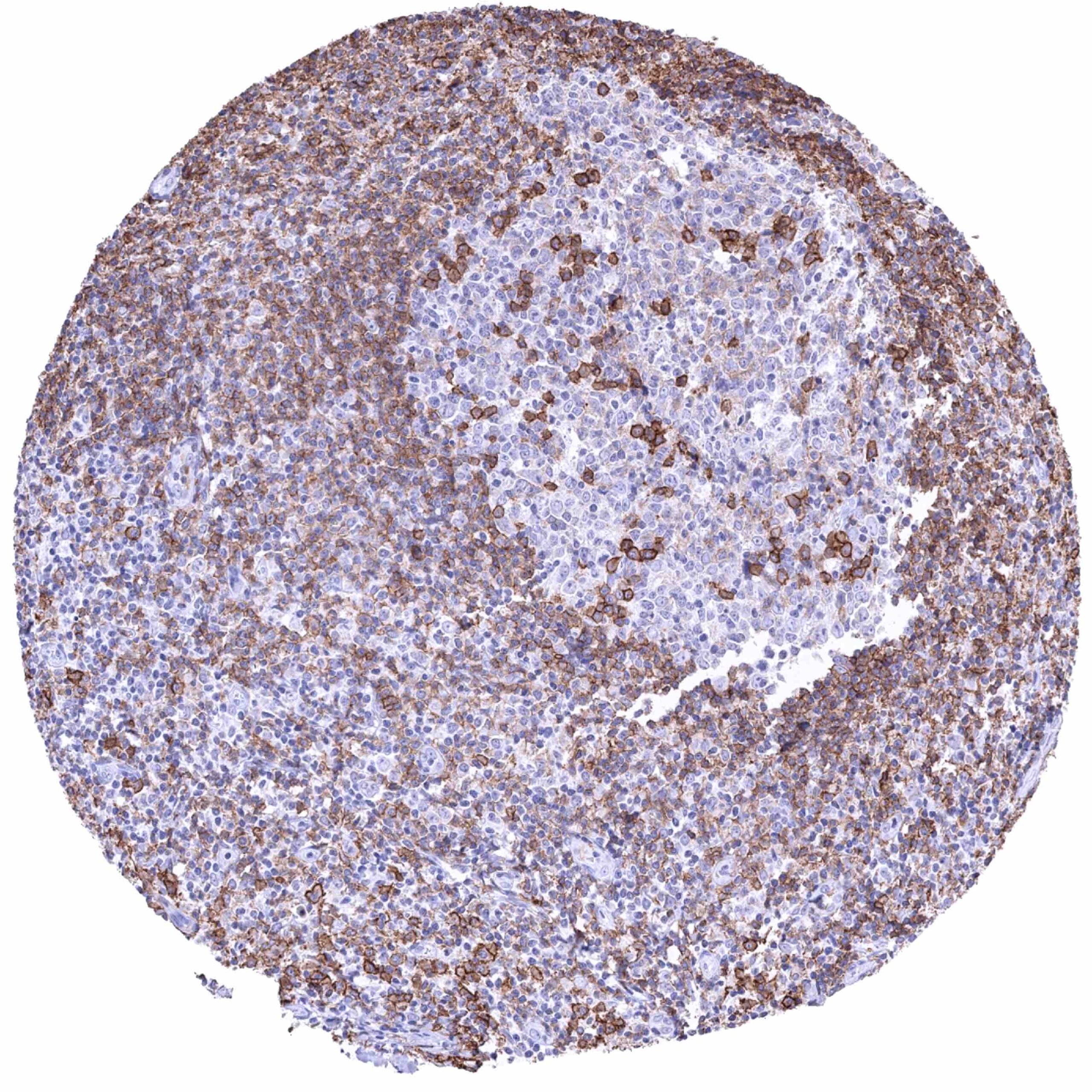 CD32B (HMV315) - MS Validated Antibodies