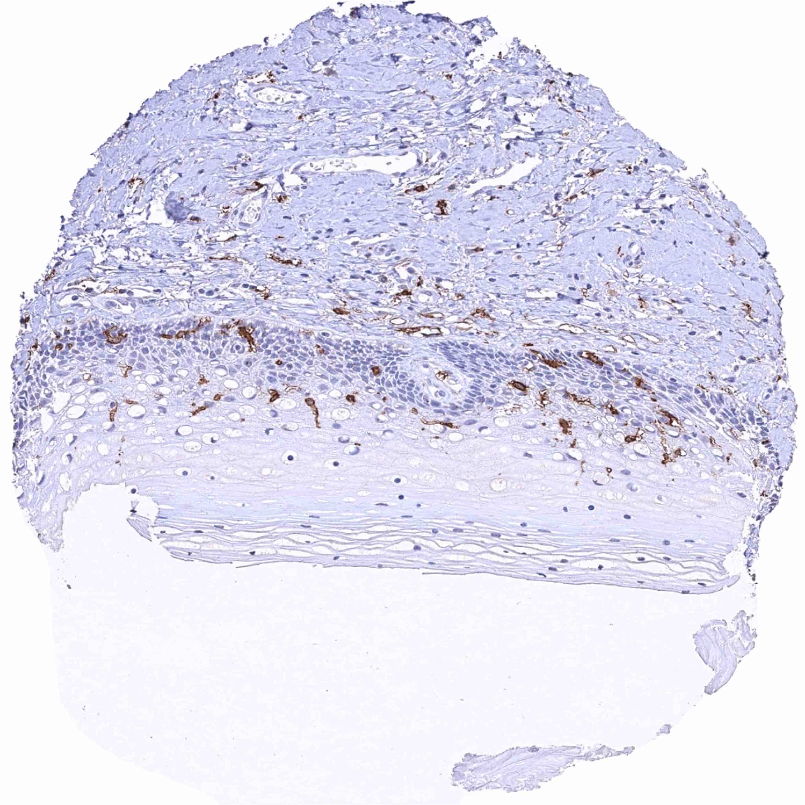 CD32B (HMV315) - MS Validated Antibodies