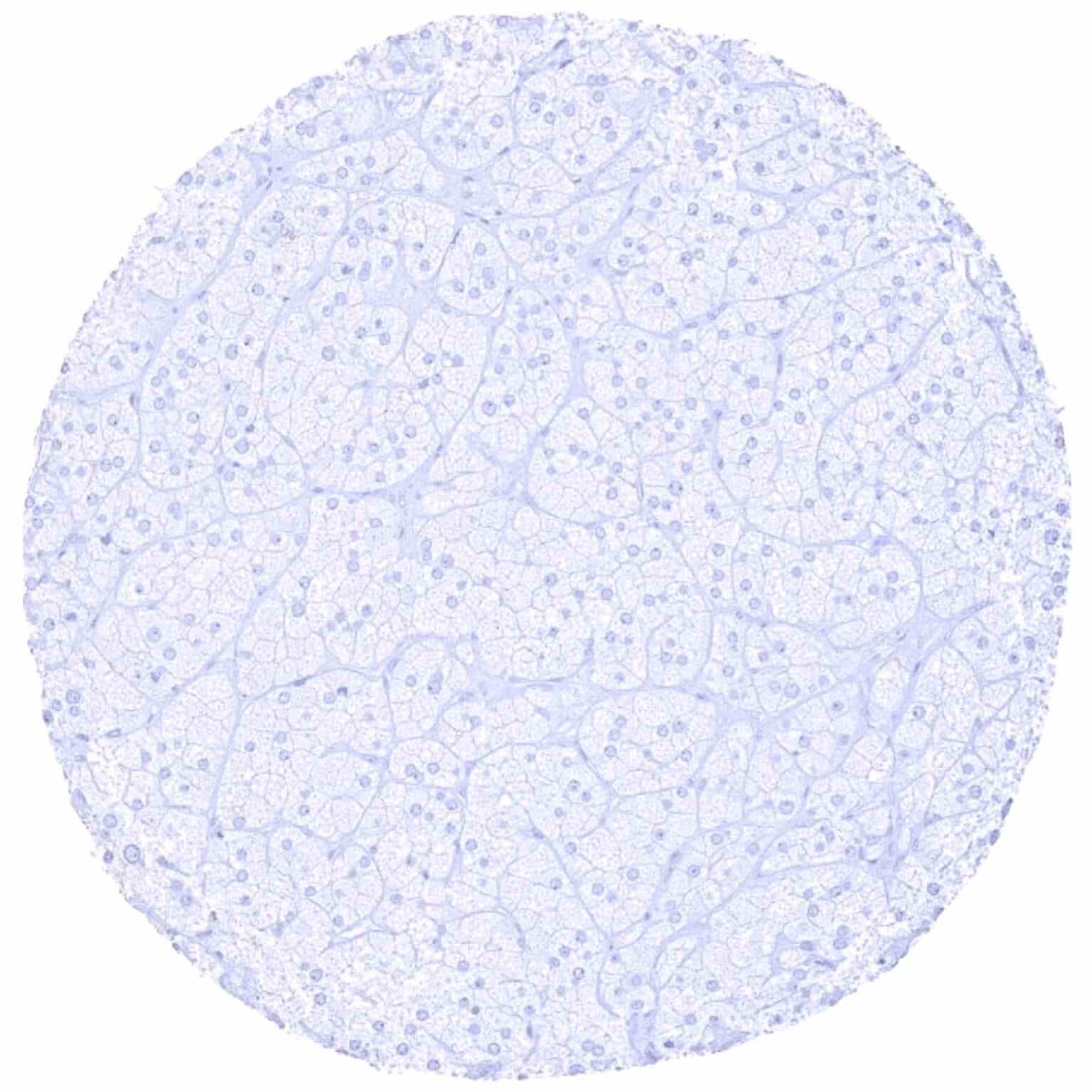 Cancer Tissue Gallery Claudin 3 - MS Validated Antibodies