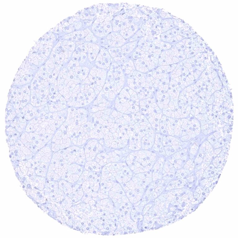 Cancer Tissue Gallery Claudin 3 - MS Validated Antibodies