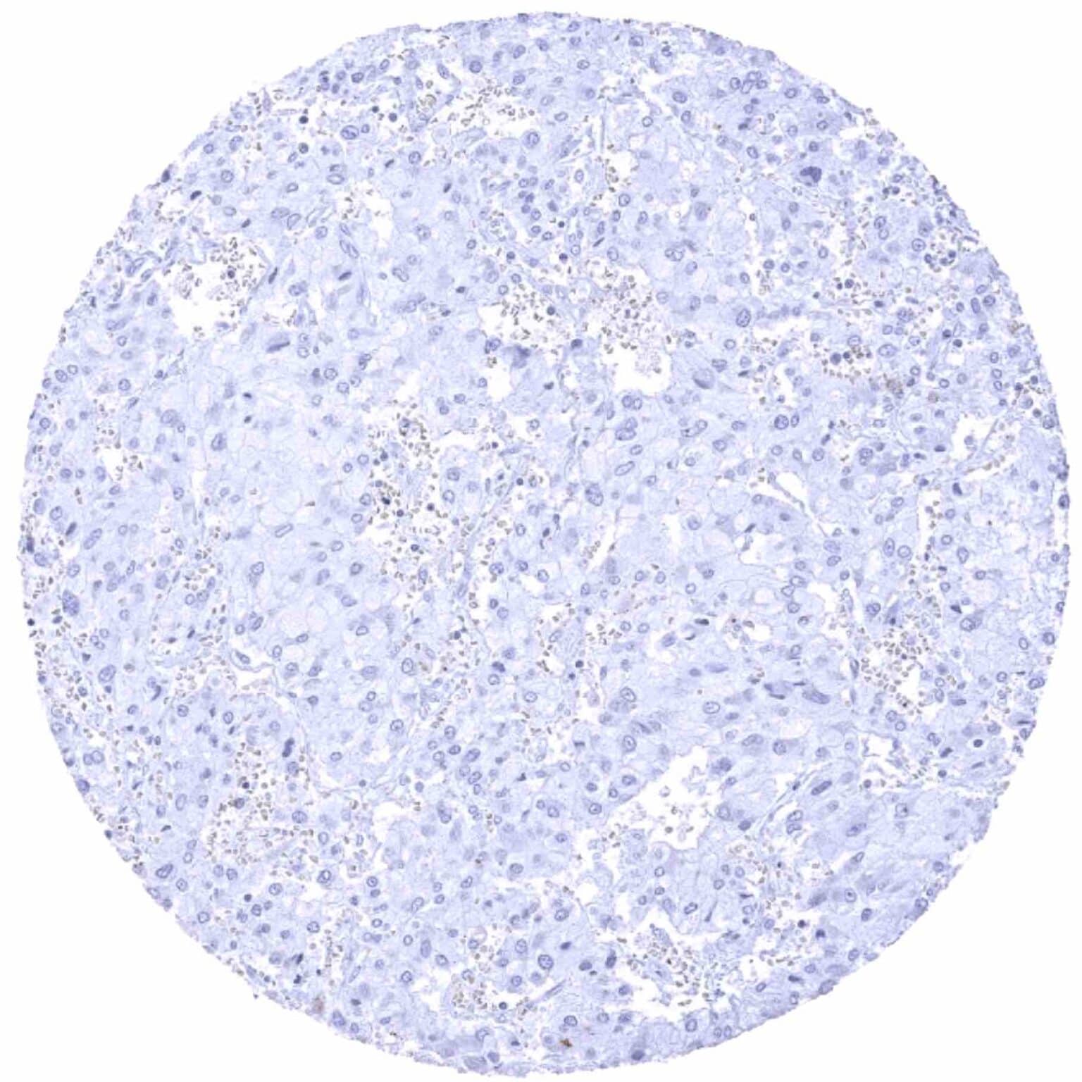 Cancer Tissue Gallery Claudin 3 - MS Validated Antibodies