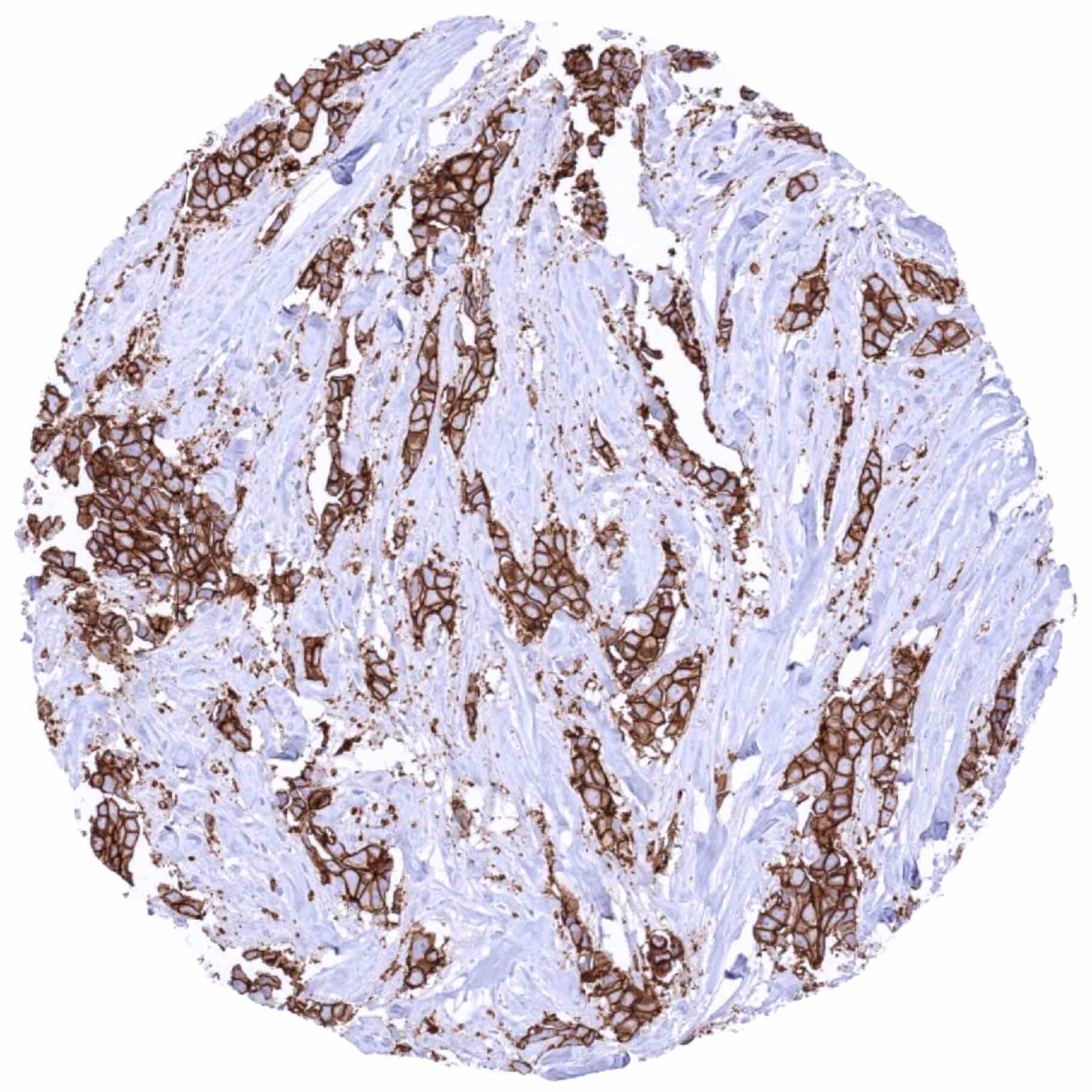 Cancer Tissue Gallery Claudin 3 - MS Validated Antibodies