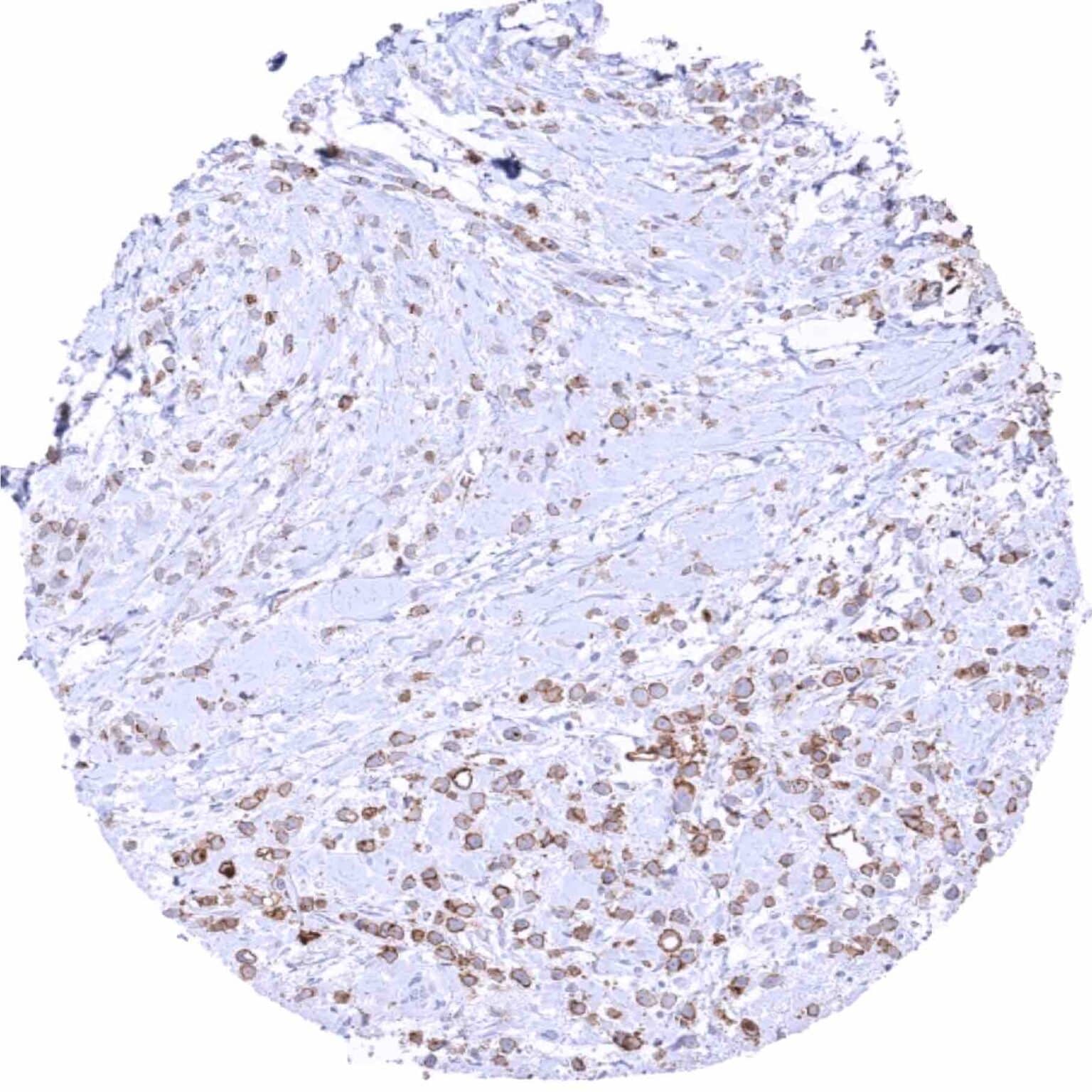 Cancer Tissue Gallery Claudin 3 - MS Validated Antibodies
