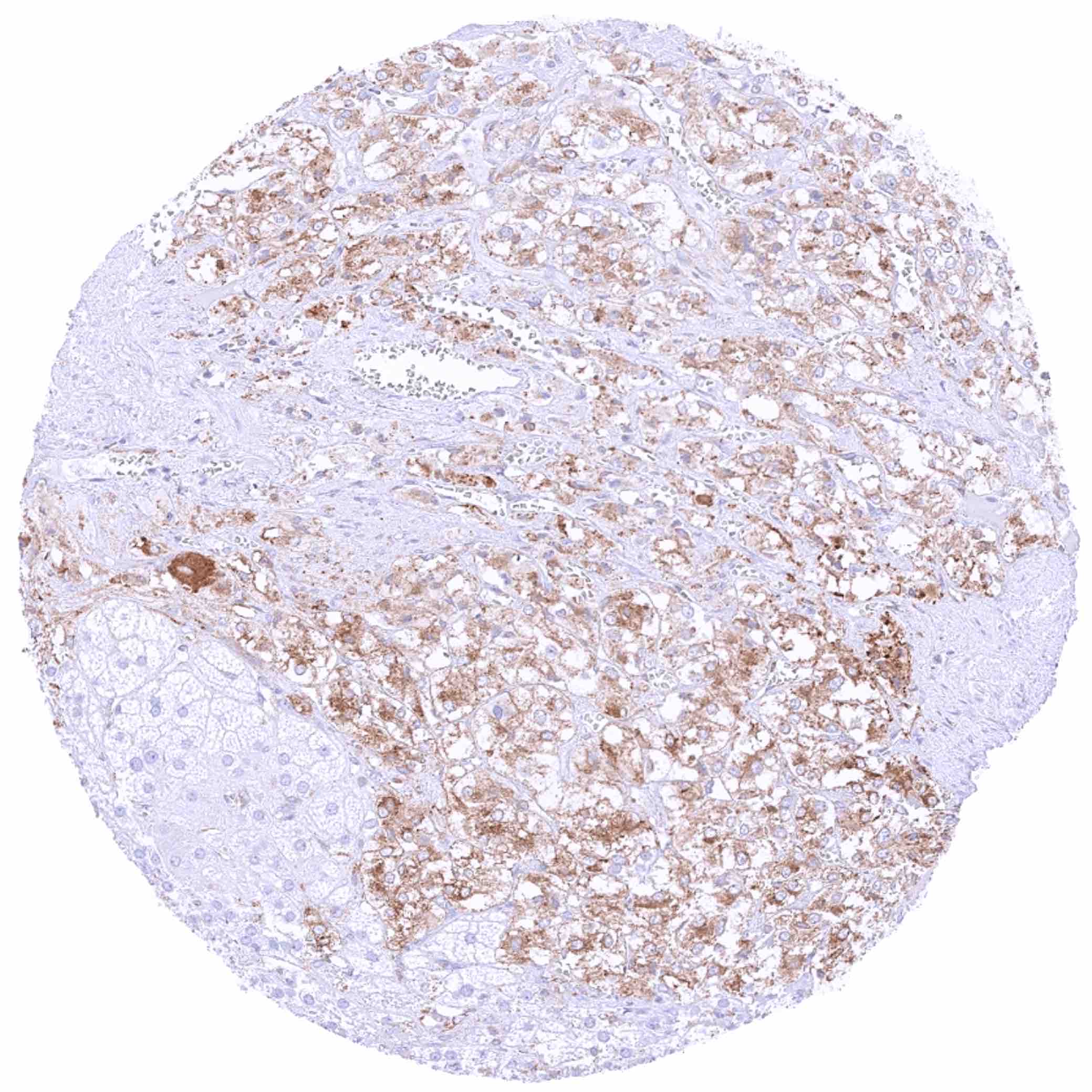 Normal Tissue Gallery MX1 - MS Validated Antibodies