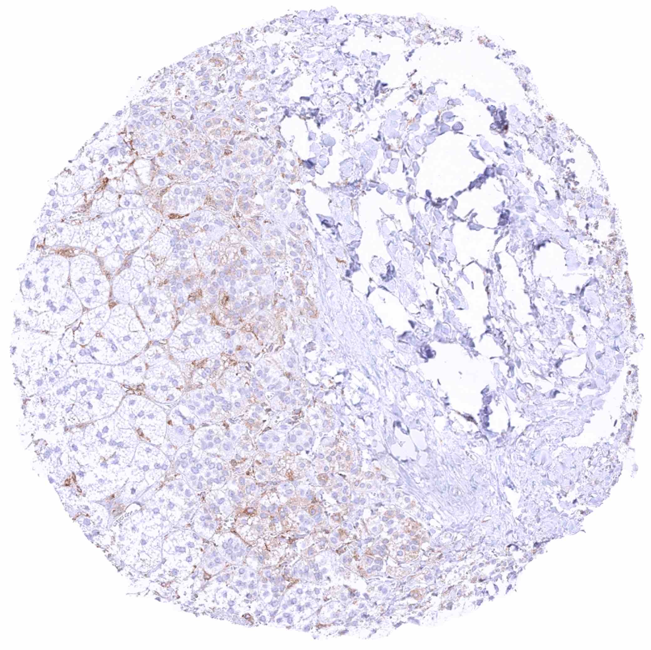 Normal Tissue Gallery MX1 - MS Validated Antibodies