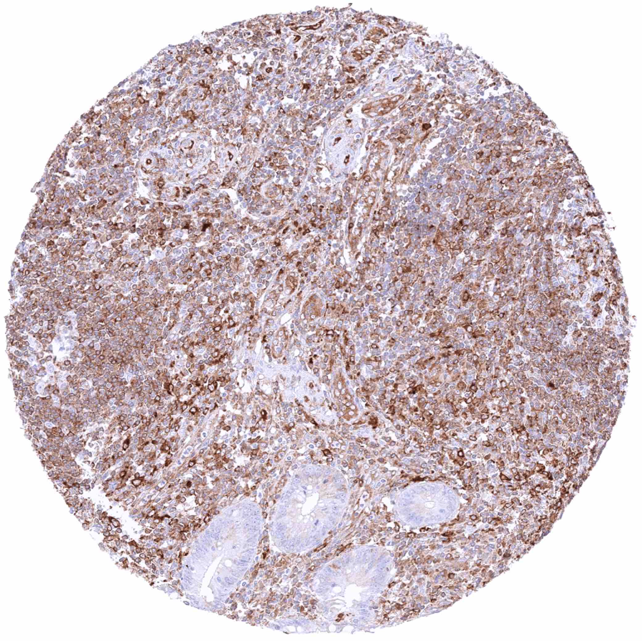 Normal Tissue Gallery MX1 - MS Validated Antibodies