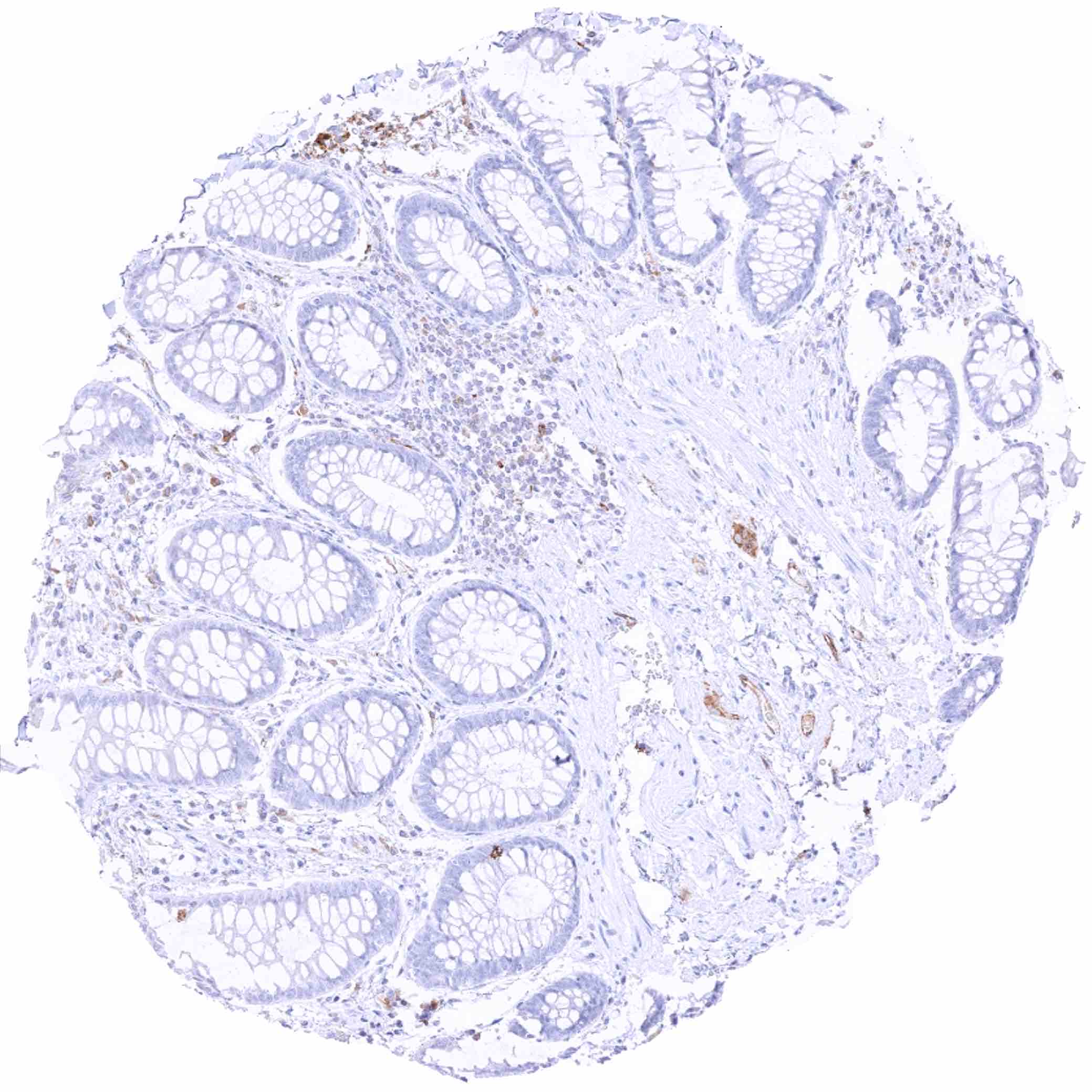 Normal Tissue Gallery MX1 - MS Validated Antibodies
