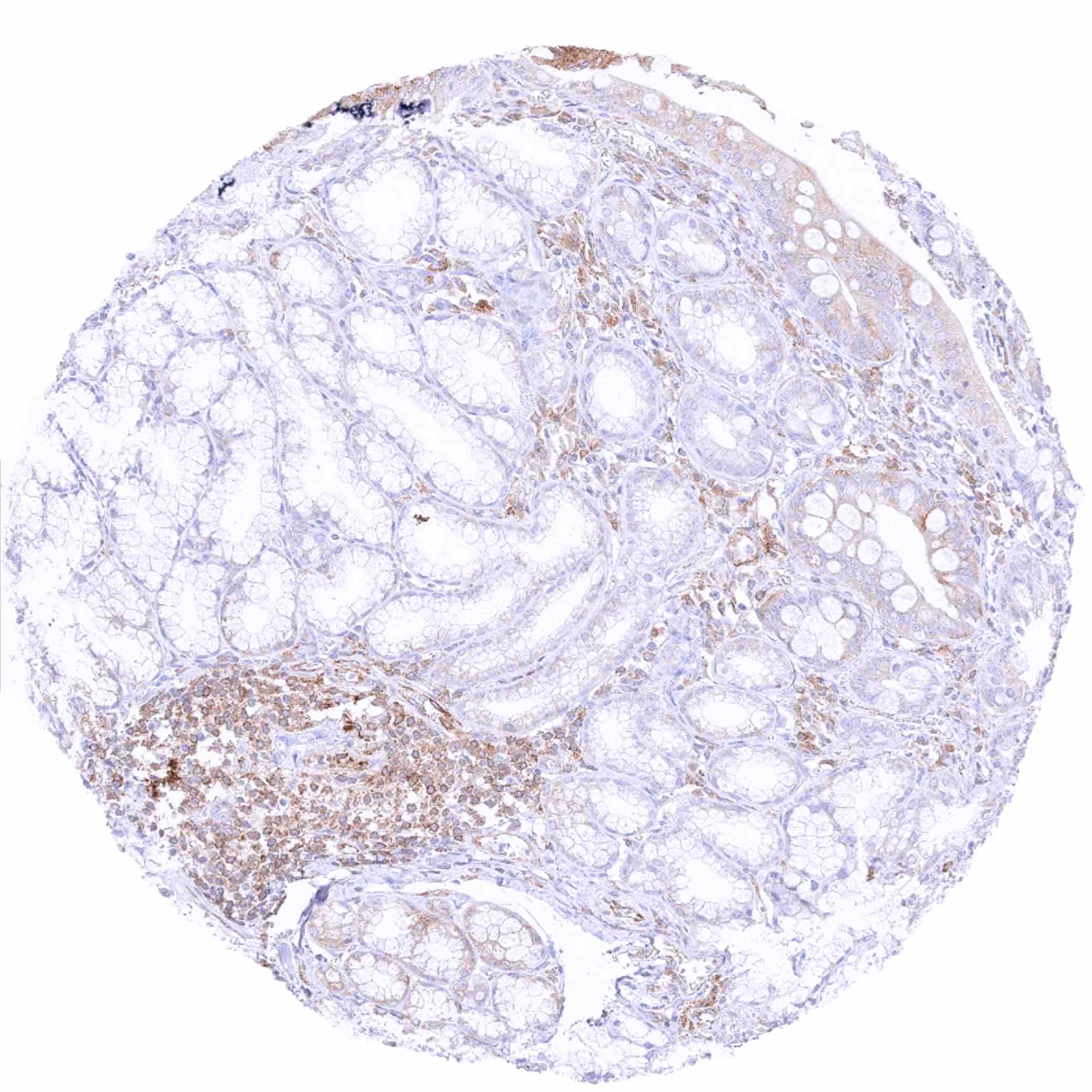 Normal Tissue Gallery MX1 - MS Validated Antibodies