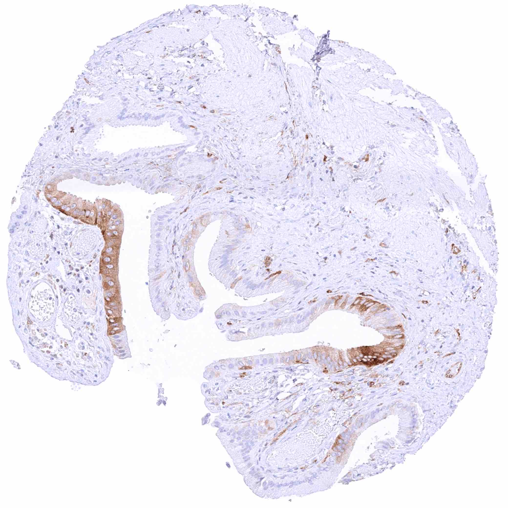 Normal Tissue Gallery MX1 - MS Validated Antibodies