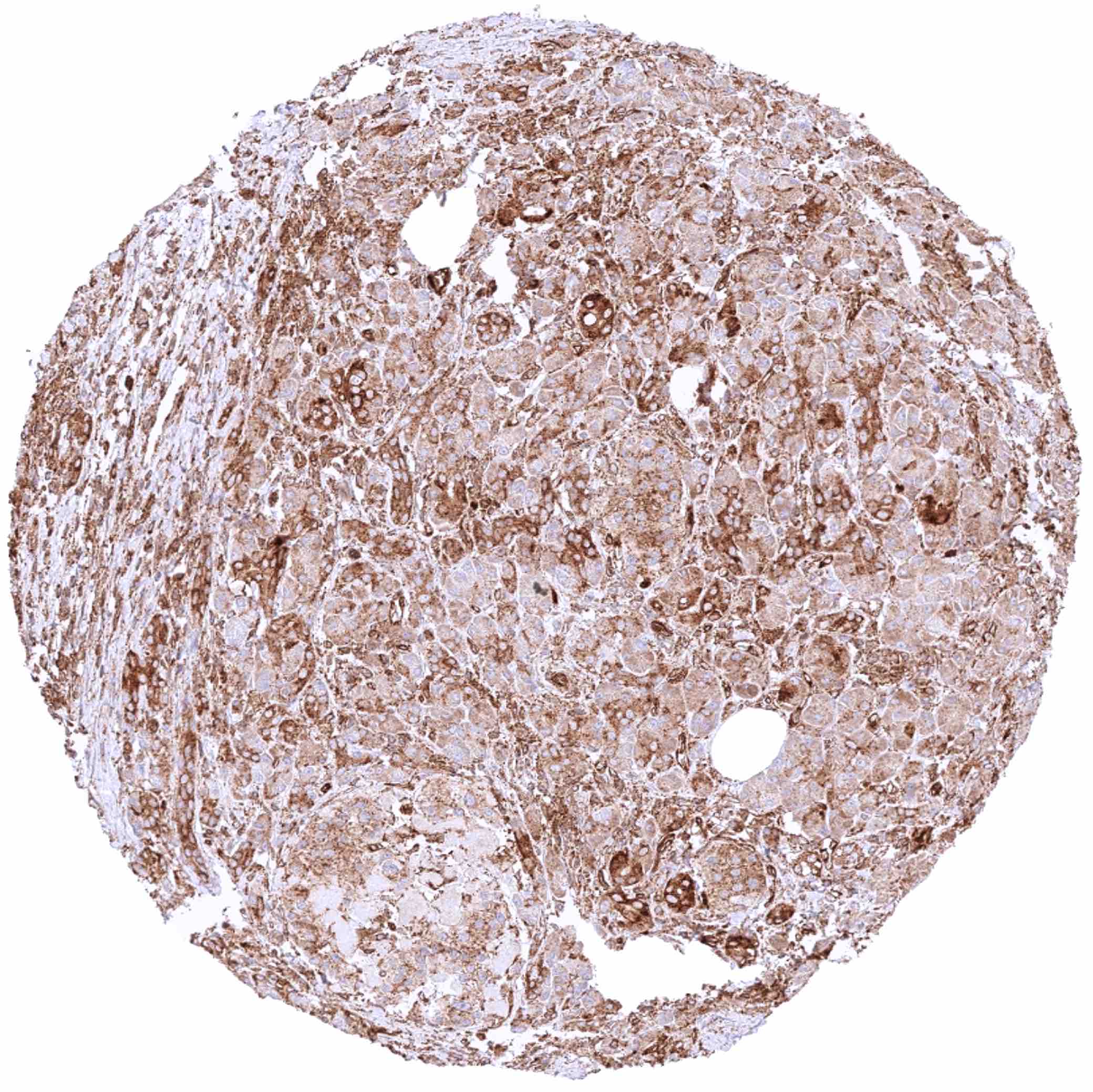 Normal Tissue Gallery MX1 - MS Validated Antibodies