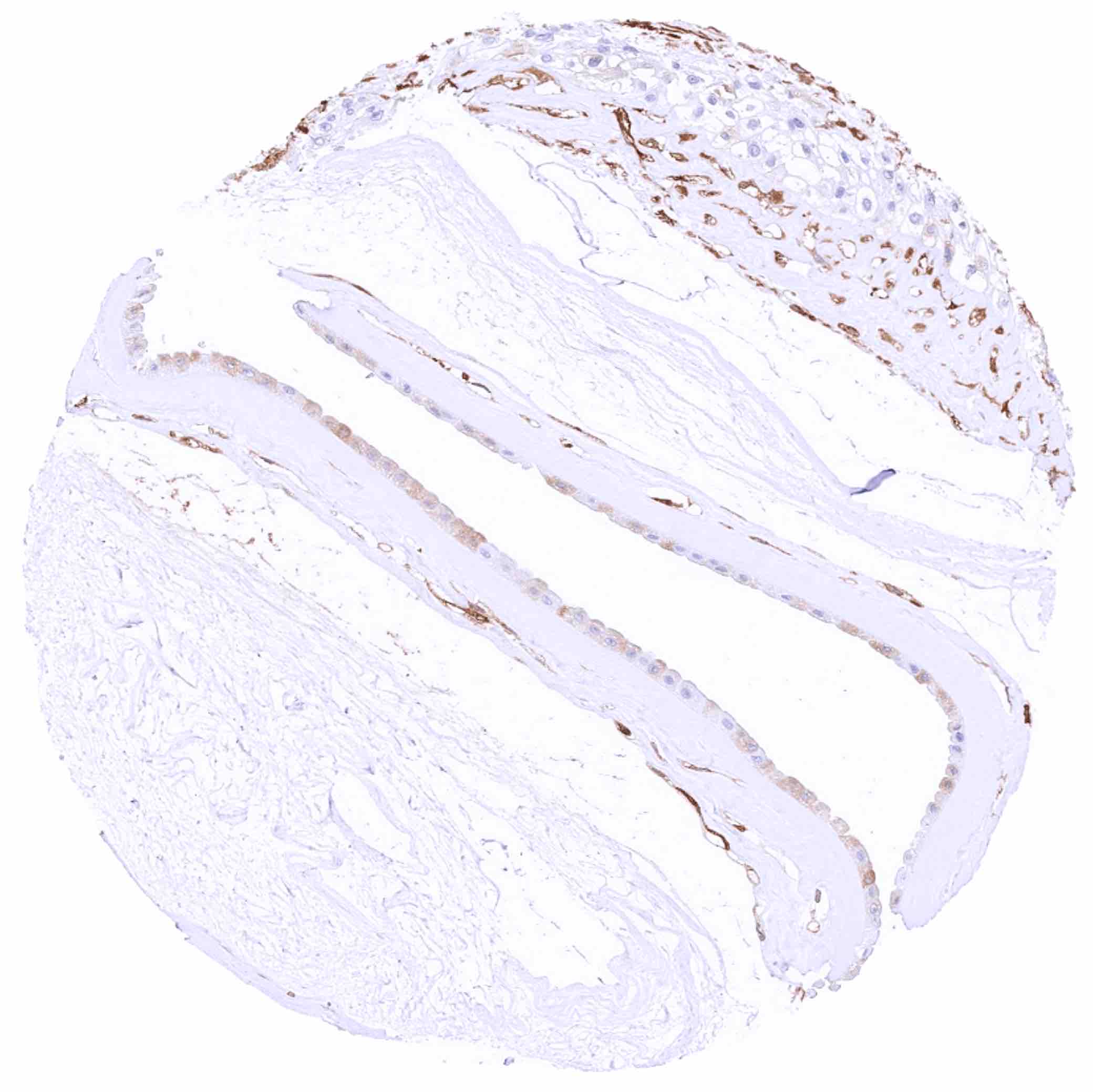 Normal Tissue Gallery MX1 - MS Validated Antibodies