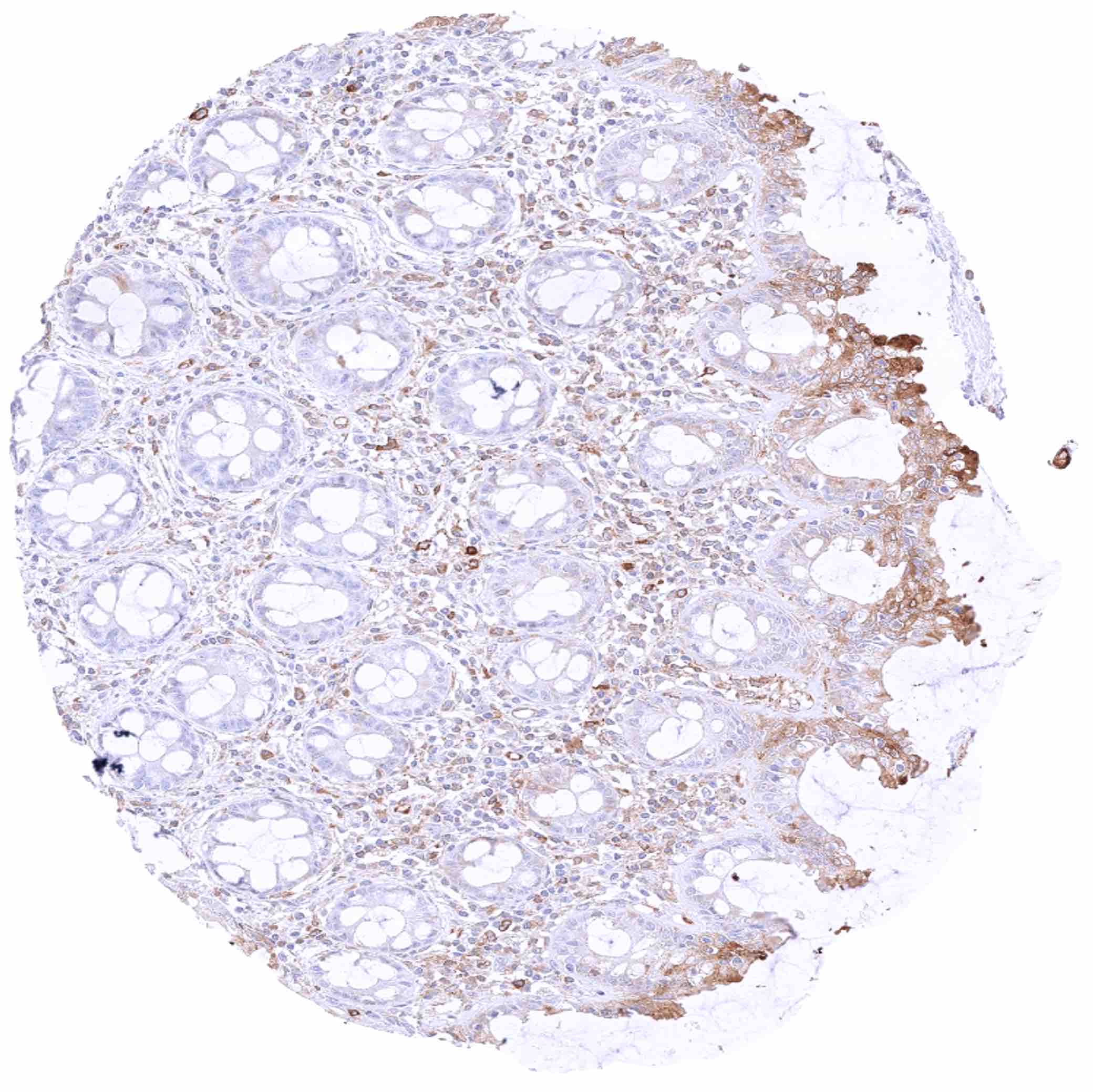 Normal Tissue Gallery MX1 - MS Validated Antibodies