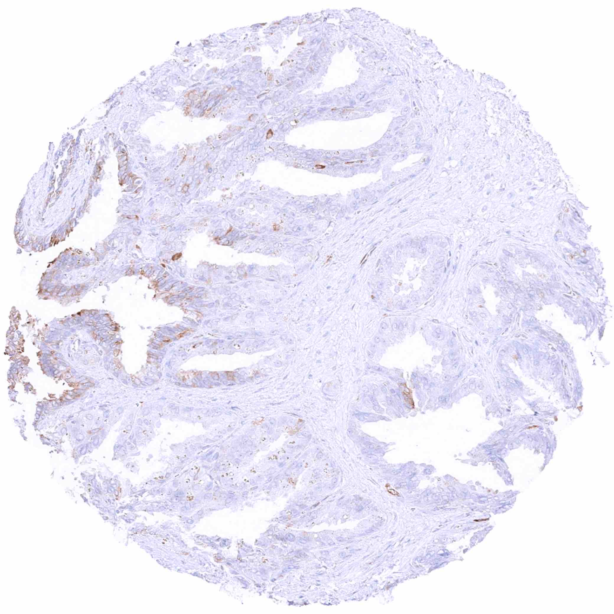 Normal Tissue Gallery MX1 - MS Validated Antibodies