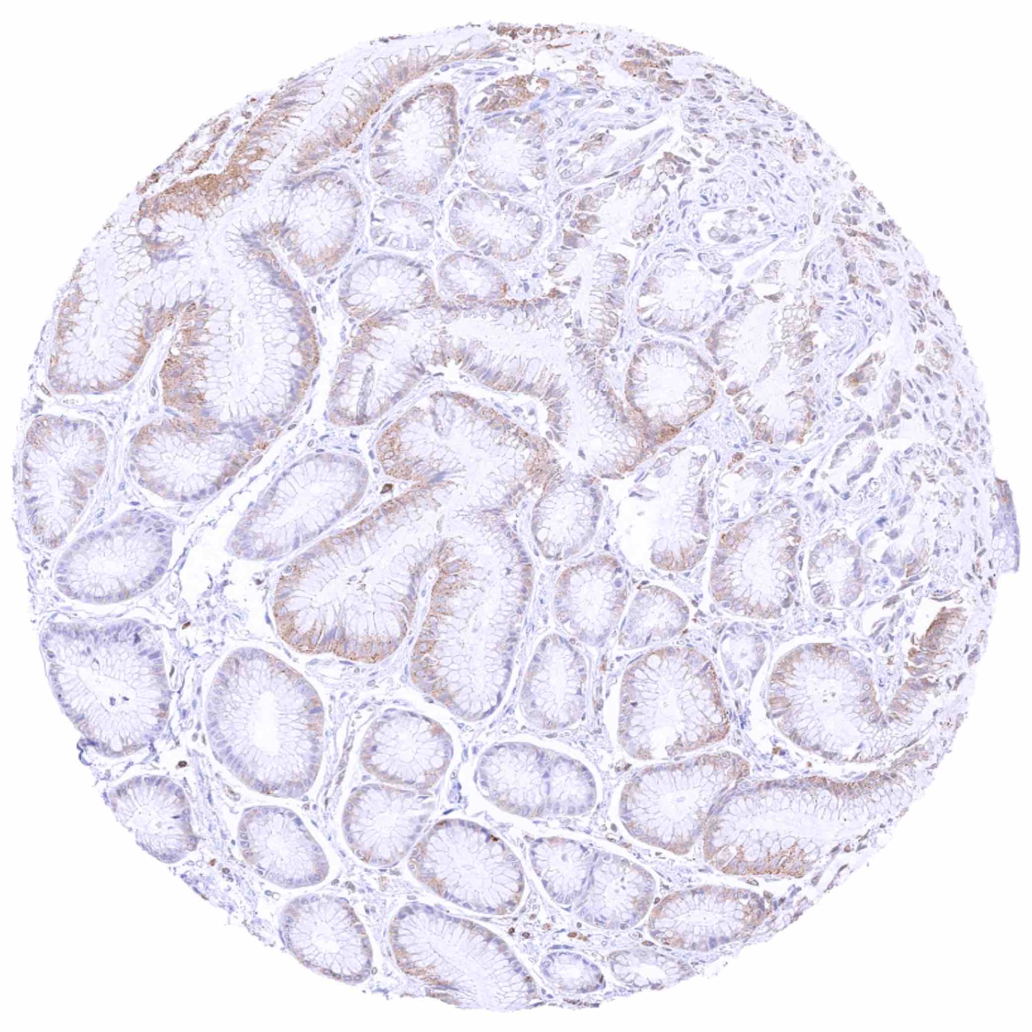 Normal Tissue Gallery MX1 - MS Validated Antibodies