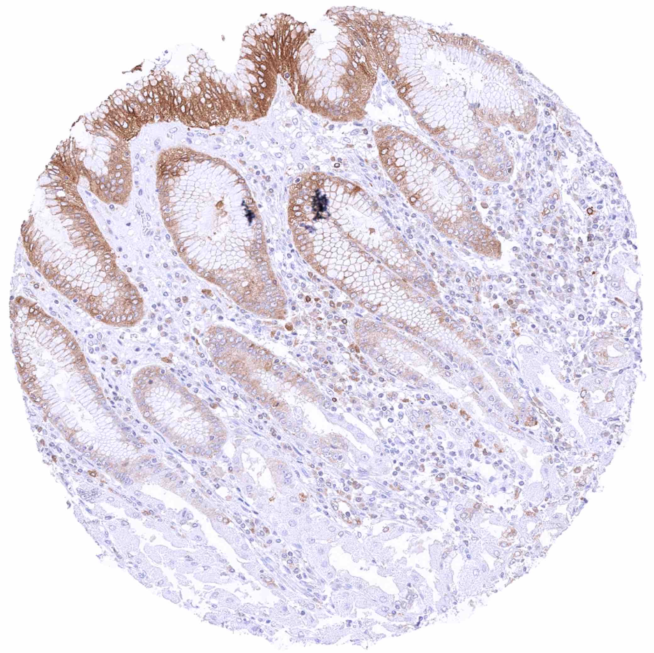 Normal Tissue Gallery MX1 - MS Validated Antibodies