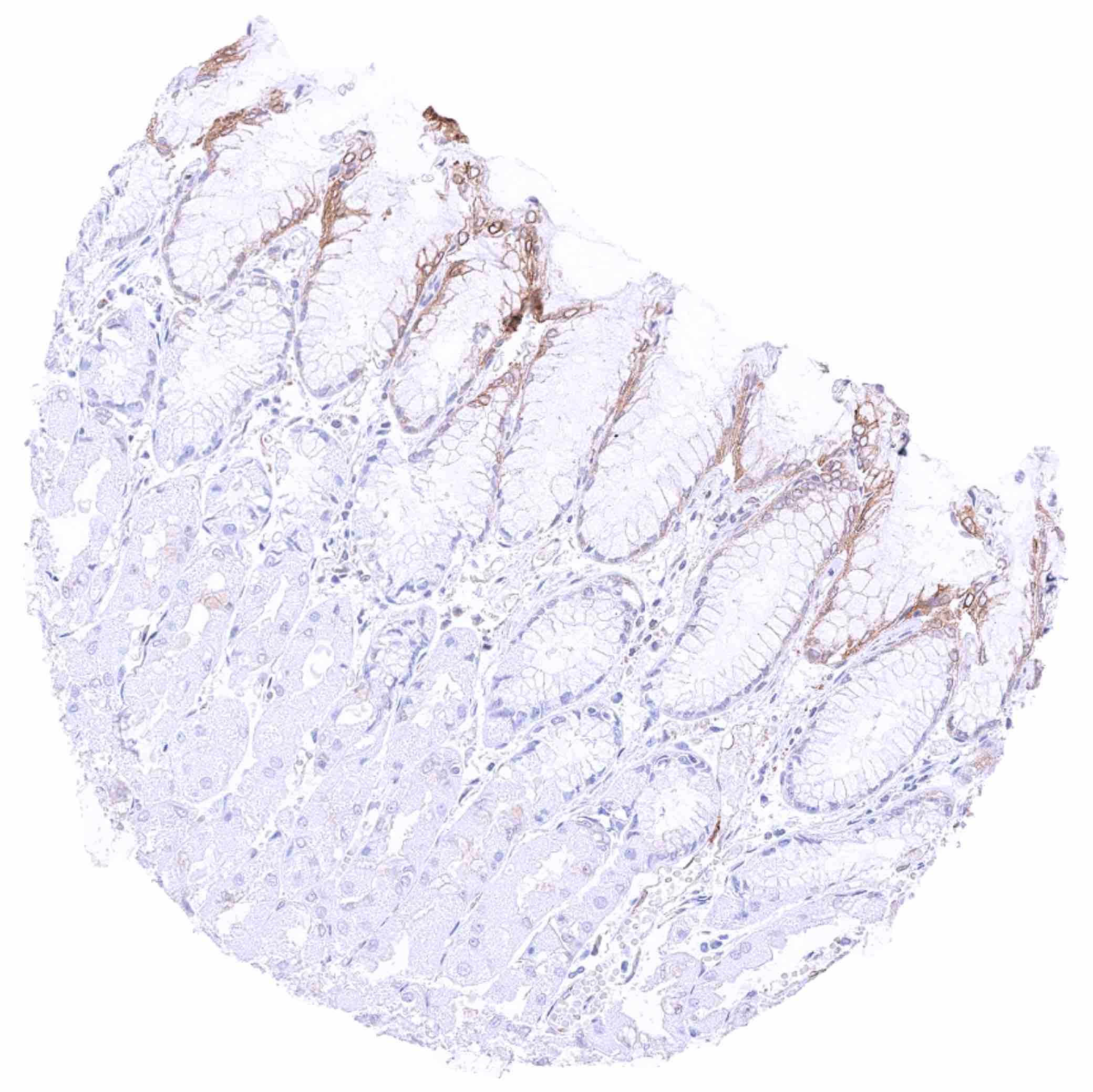 Normal Tissue Gallery MX1 - MS Validated Antibodies