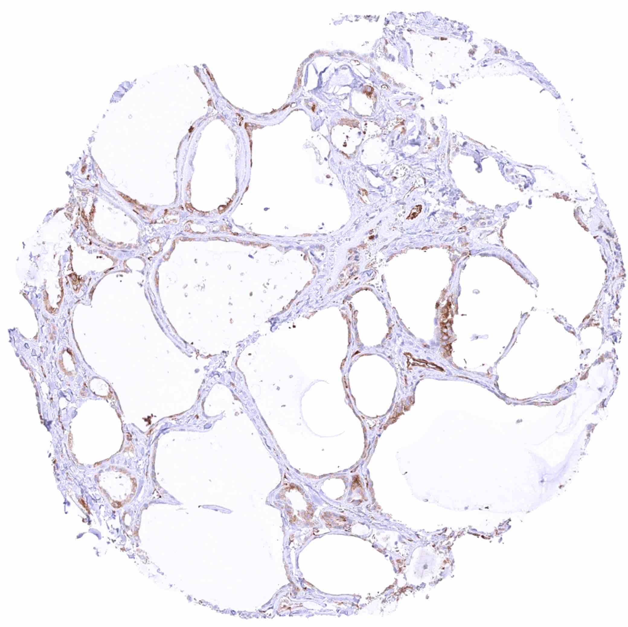 Normal Tissue Gallery MX1 - MS Validated Antibodies