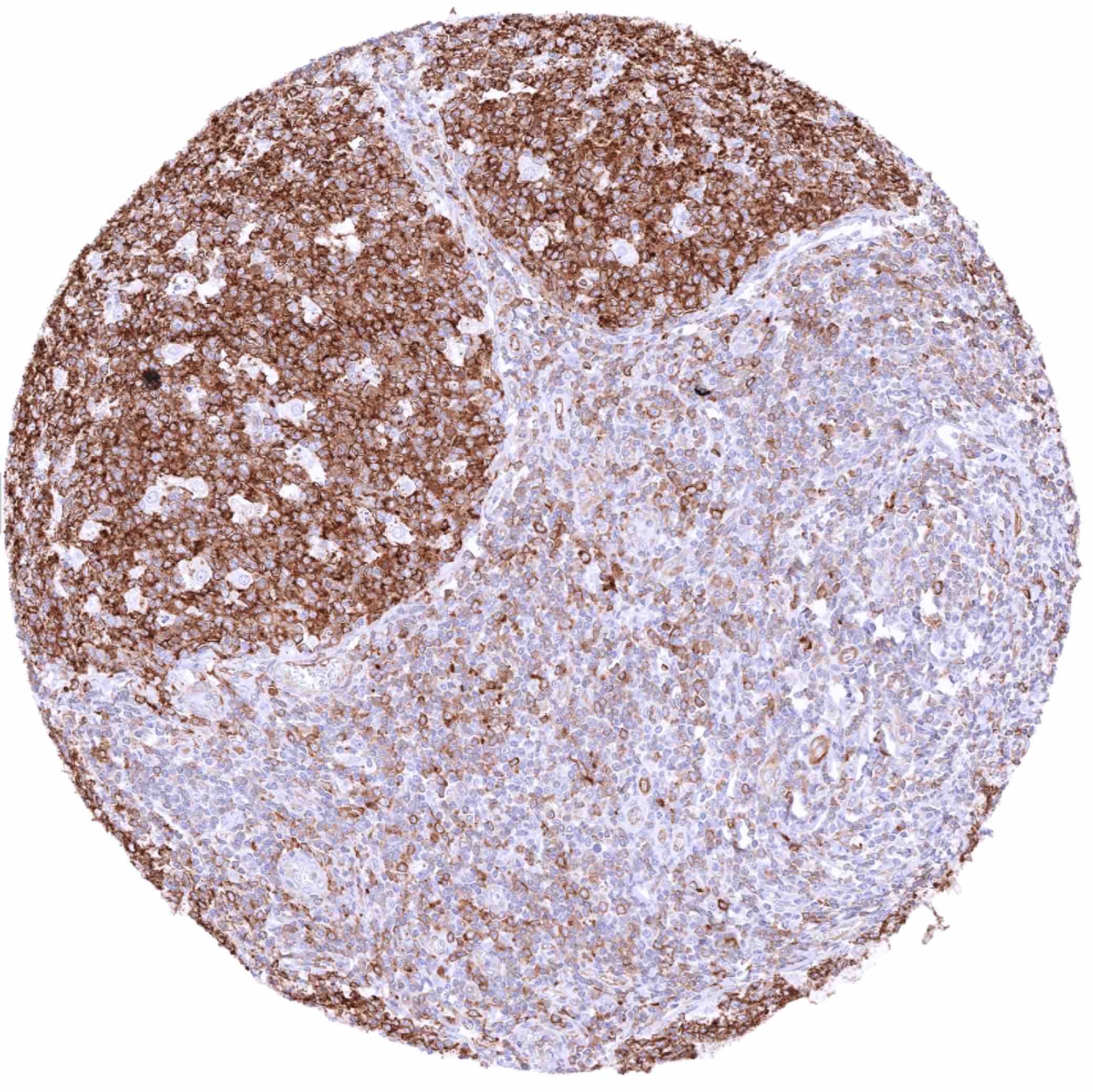 Normal Tissue Gallery MX1 - MS Validated Antibodies