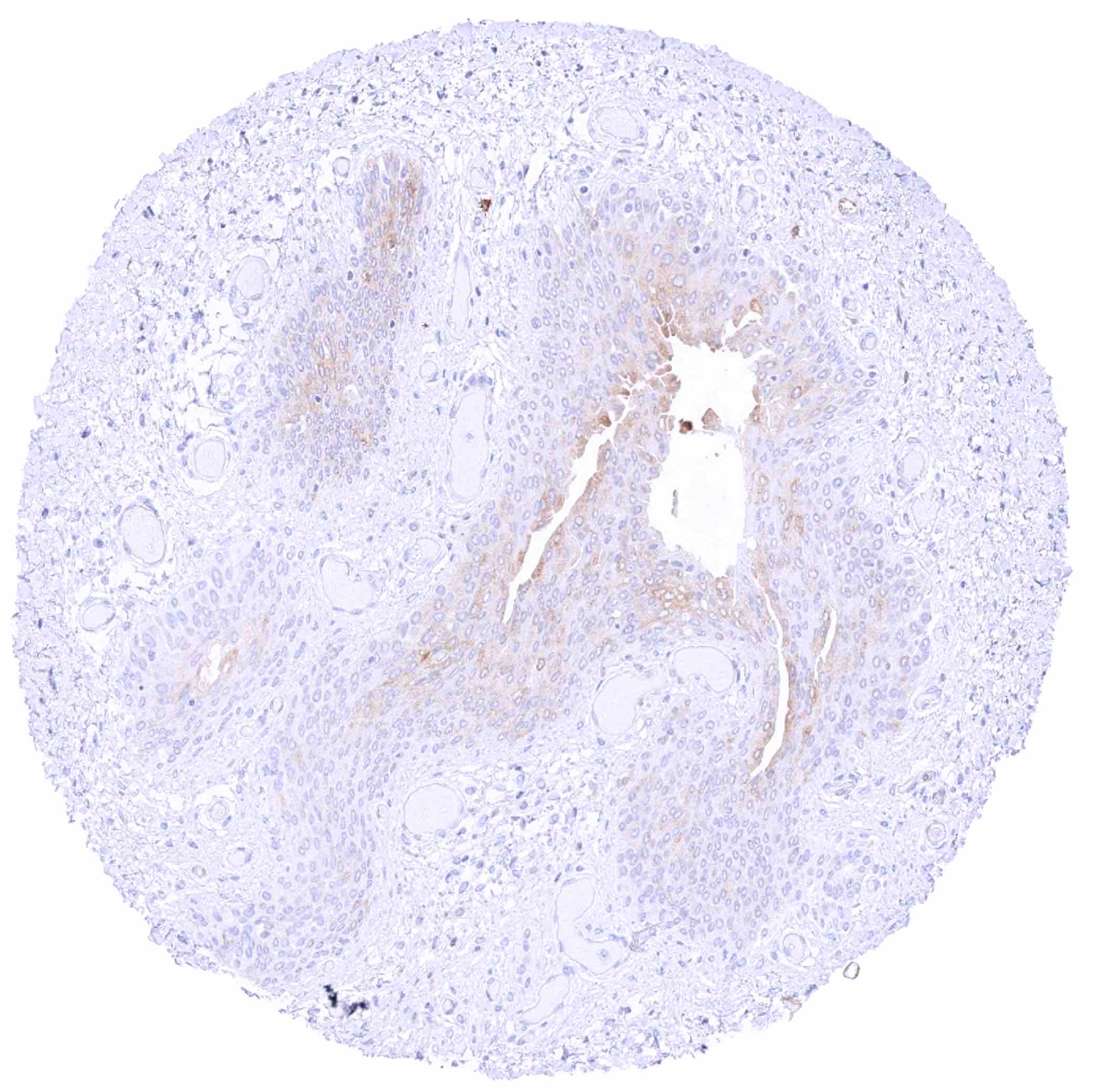 Normal Tissue Gallery MX1 - MS Validated Antibodies