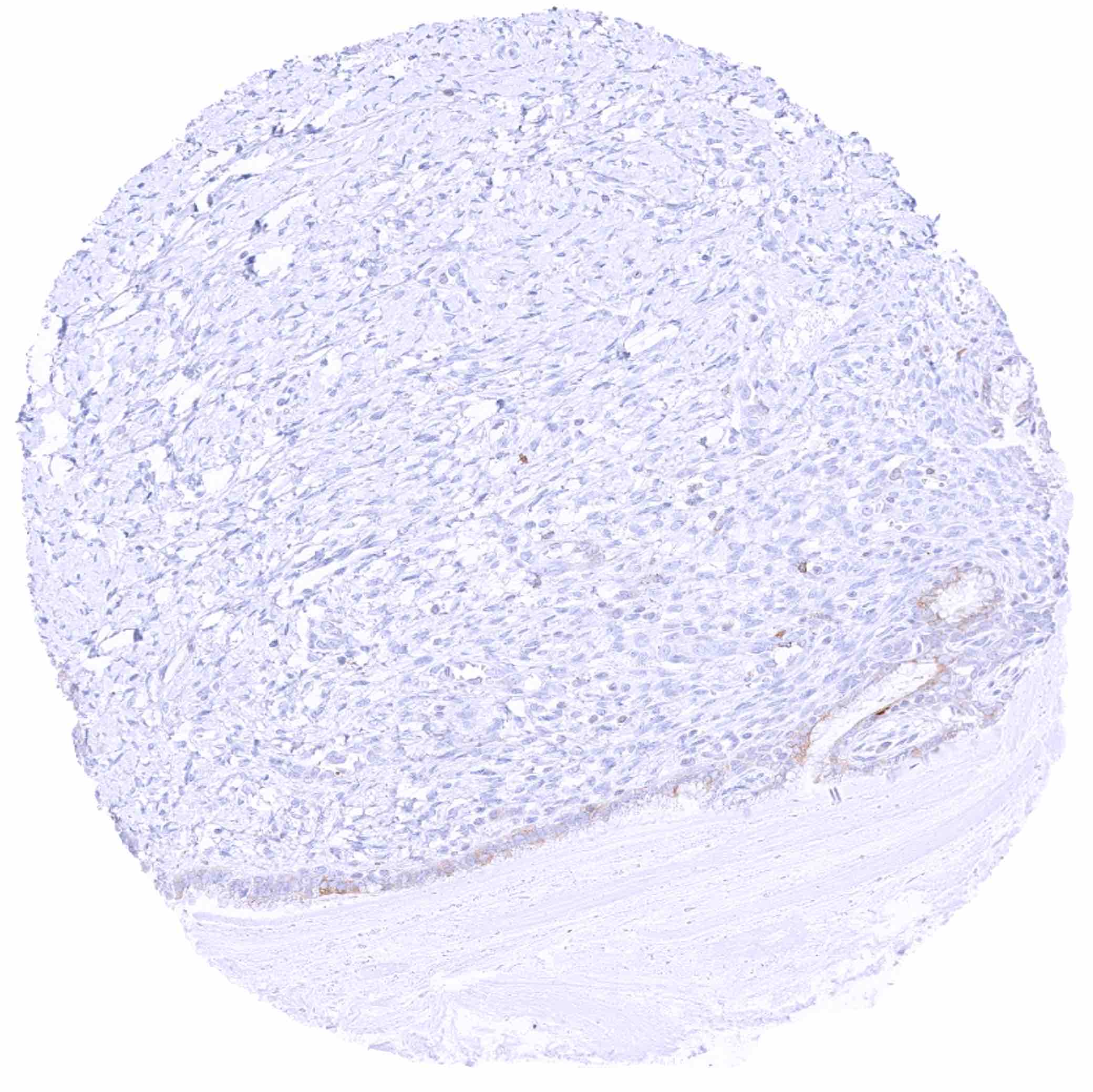 Normal Tissue Gallery MX1 - MS Validated Antibodies