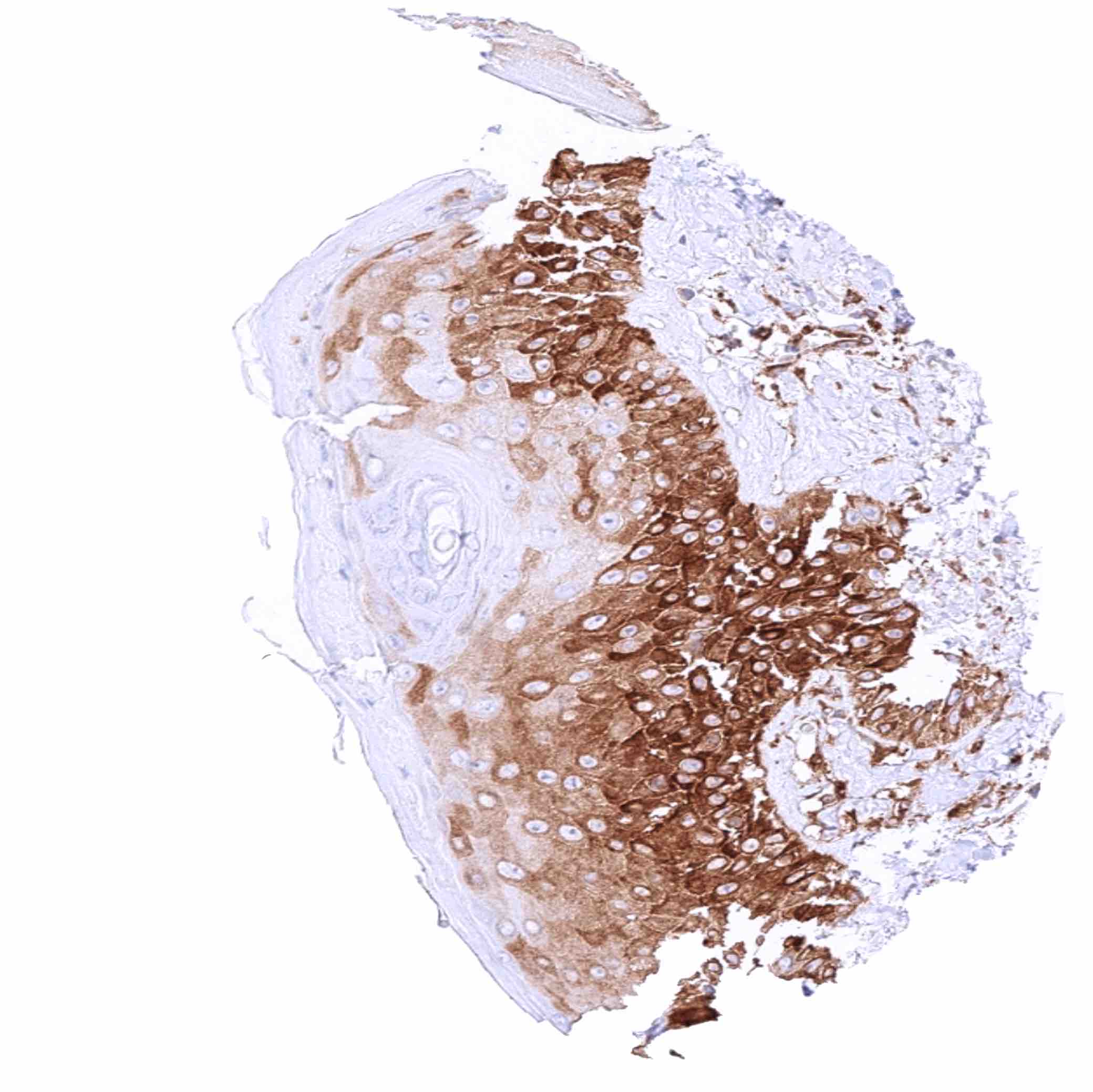 Normal Tissue Gallery MX1 - MS Validated Antibodies