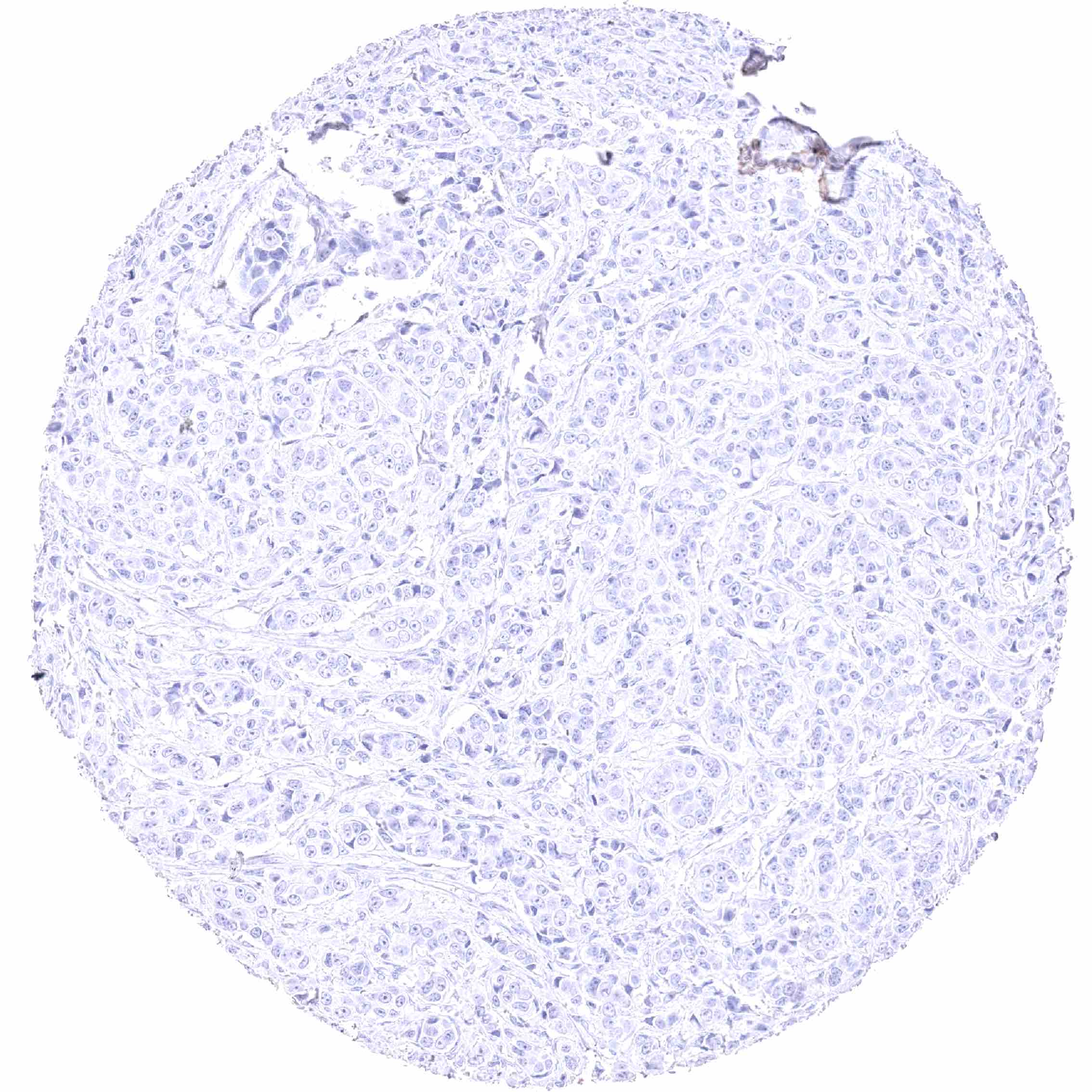 Cancer Tissue Gallery GPM6A - MS Validated Antibodies