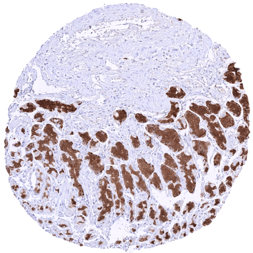 Pepsinogen I (HMV318) - MS Validated Antibodies