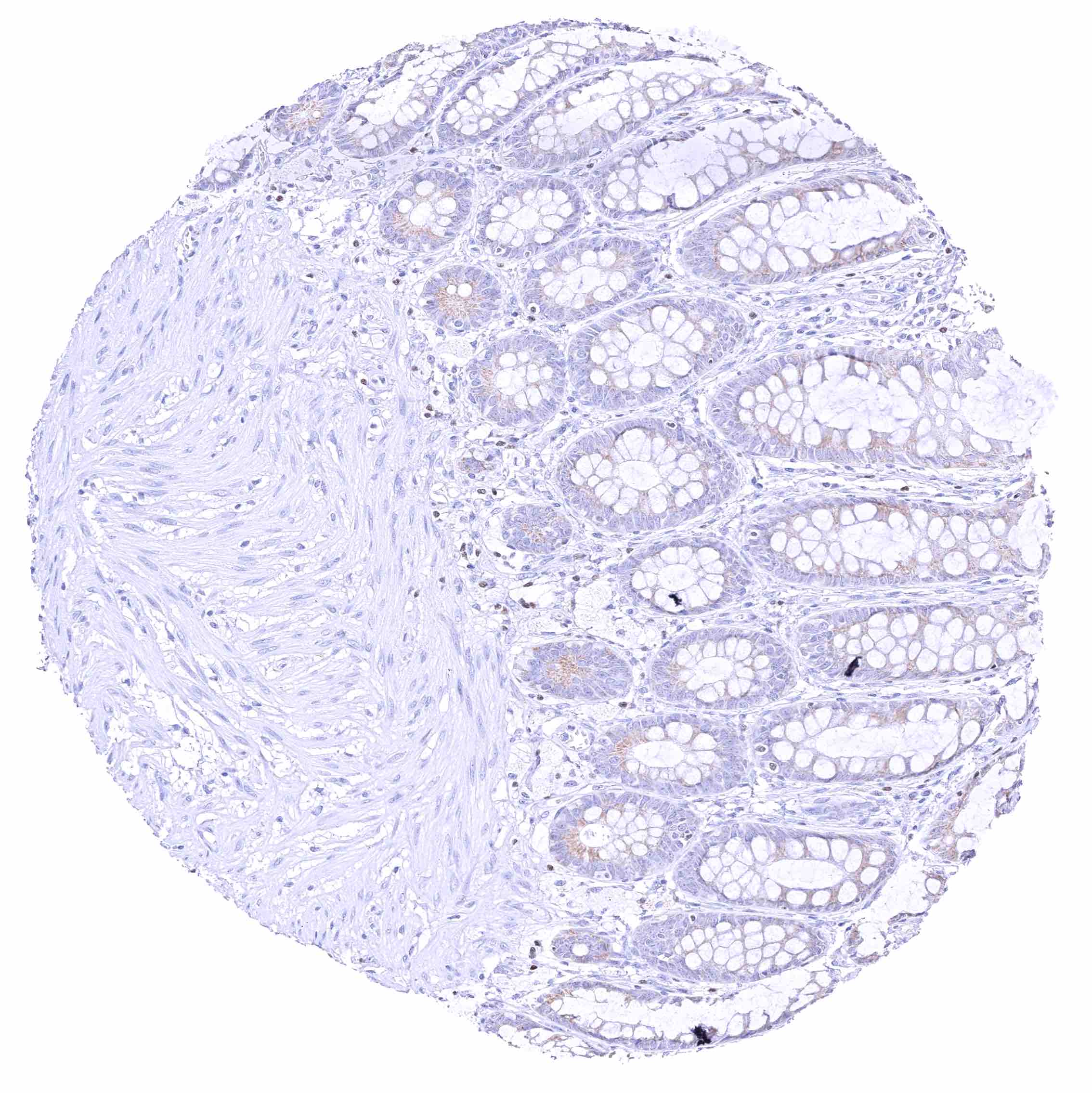 GATA3 (MSVA-550R) - MS Validated Antibodies