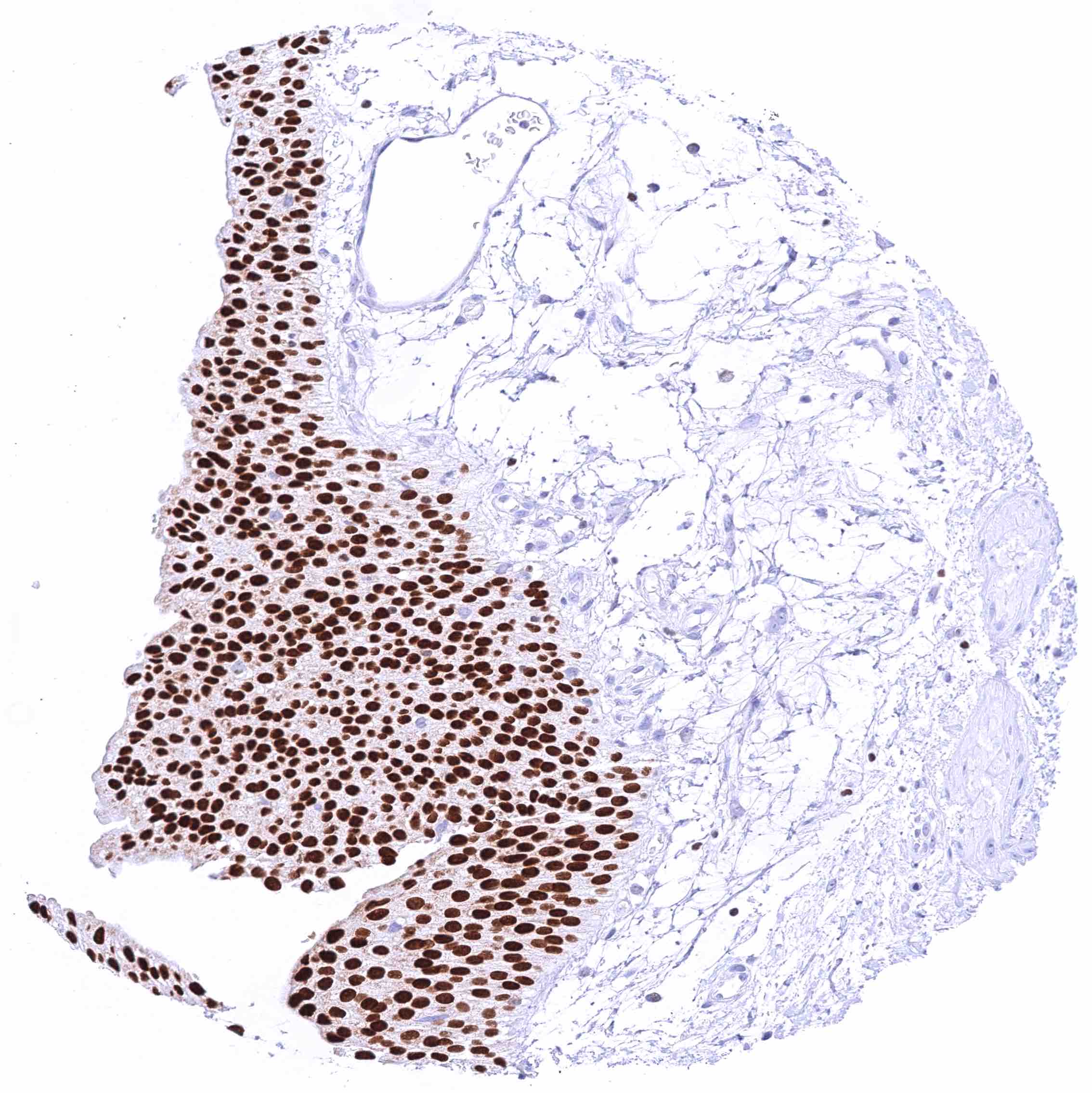 GATA3 (MSVA-550R) - MS Validated Antibodies