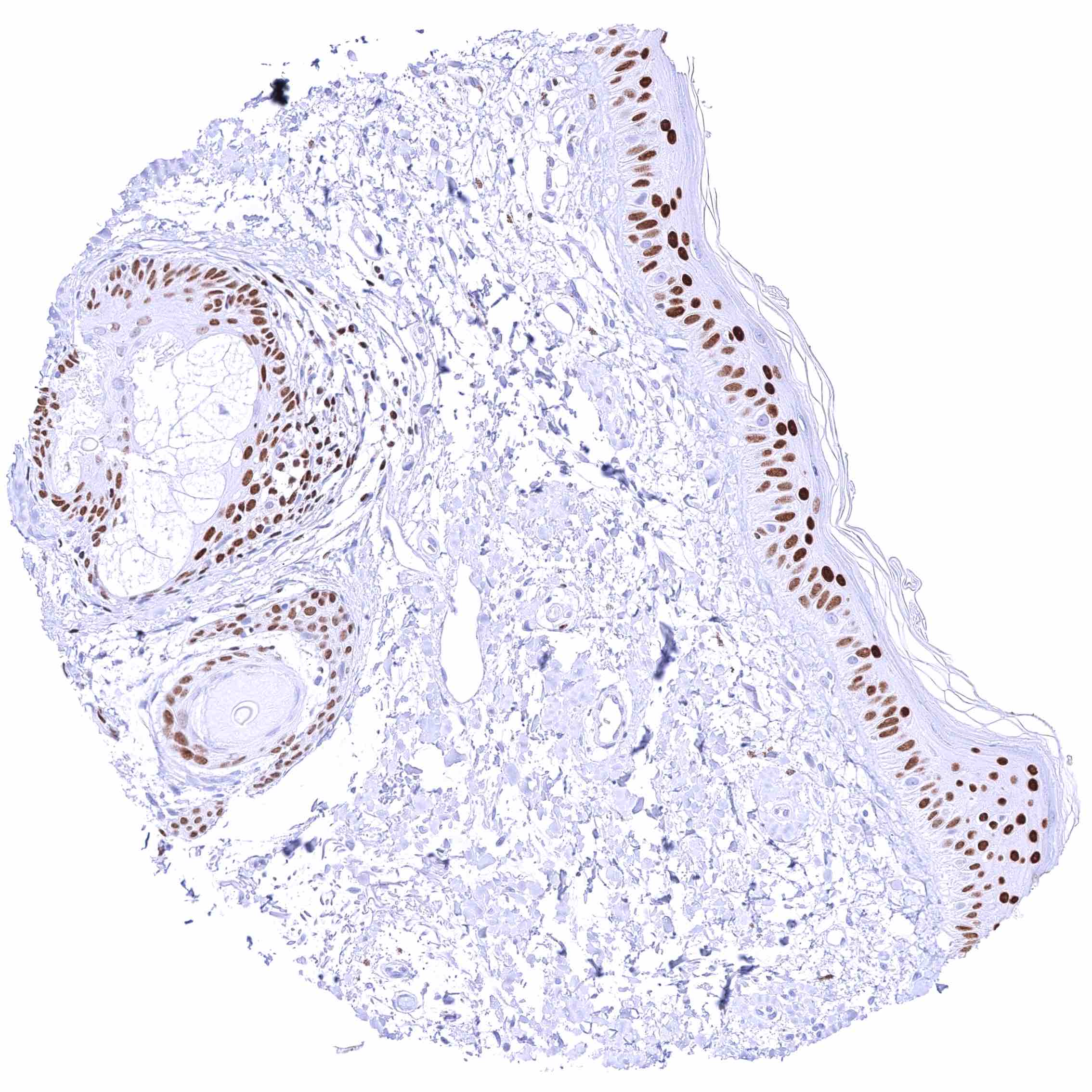 GATA3 (MSVA-550R) - MS Validated Antibodies