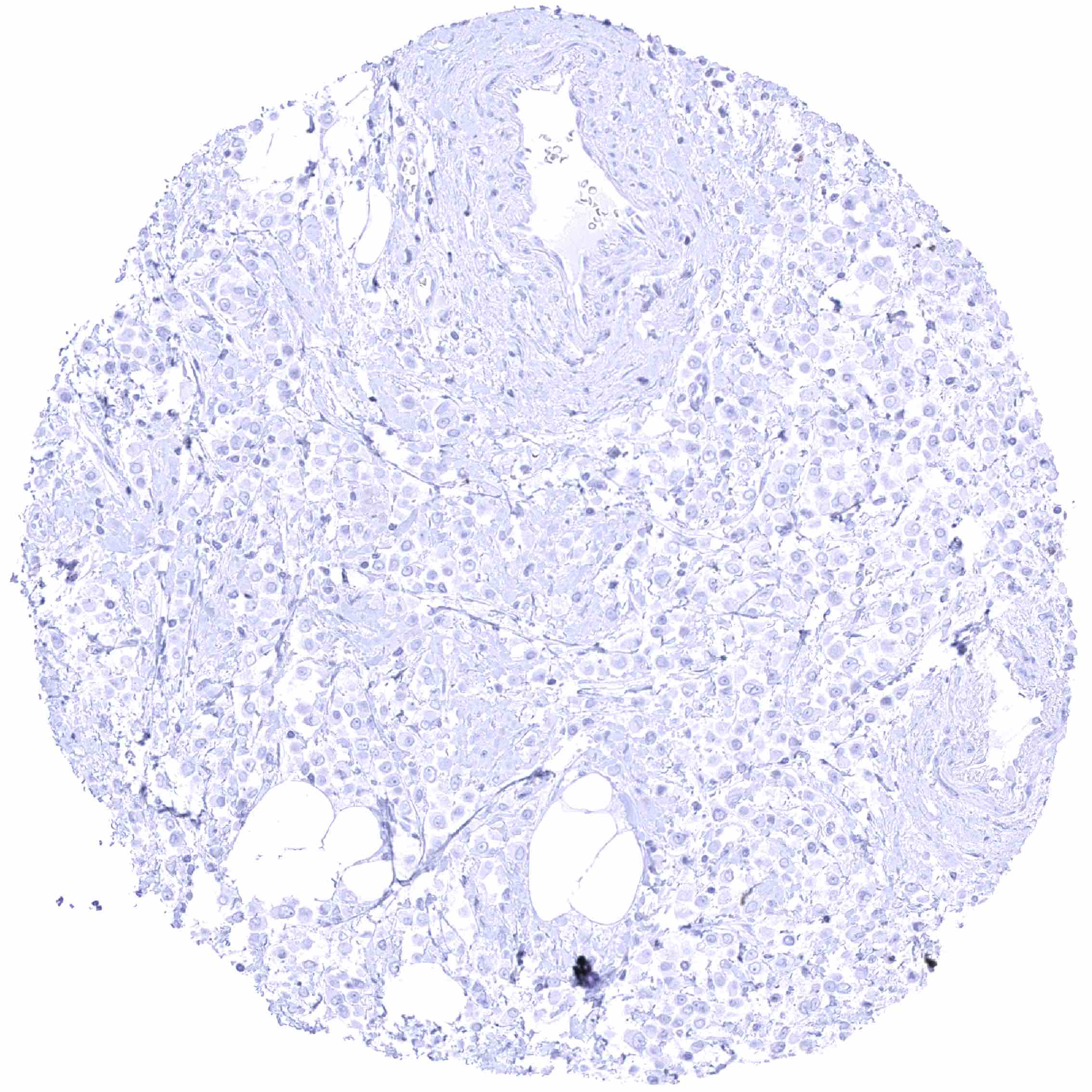 Cancer Tissue Gallery CD35 - MS Validated Antibodies