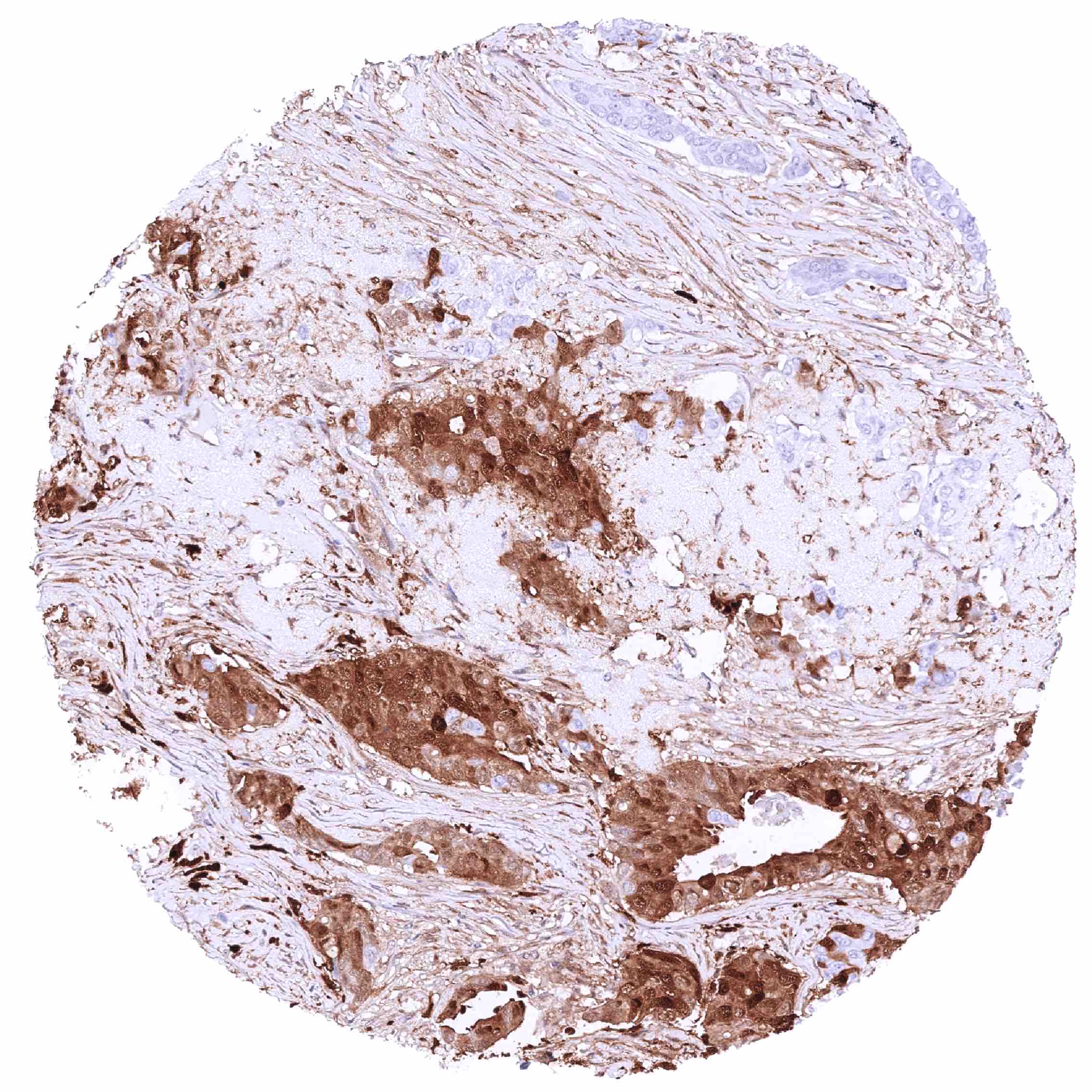 Cancer Tissue Gallery GSTP1 - MS Validated Antibodies