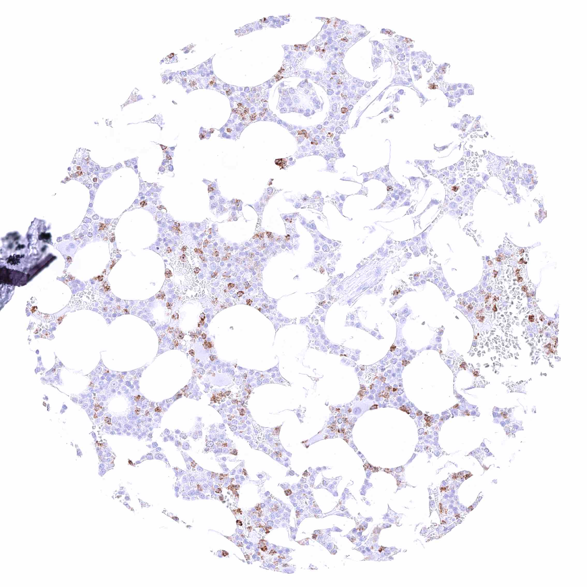 CD35 (MSVA-035M) - MS Validated Antibodies