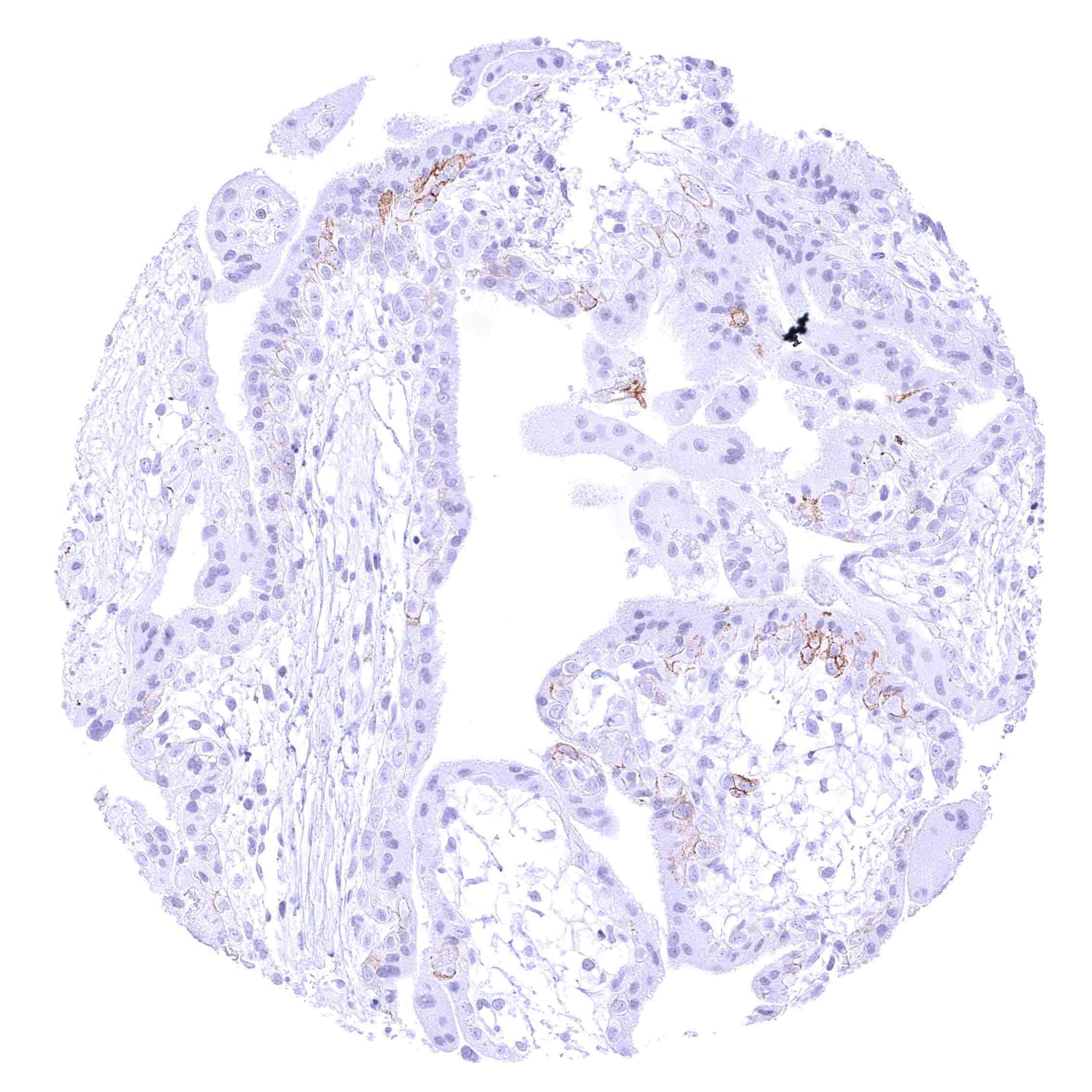 Claudin-6 (MSVA-916R) - MS Validated Antibodies