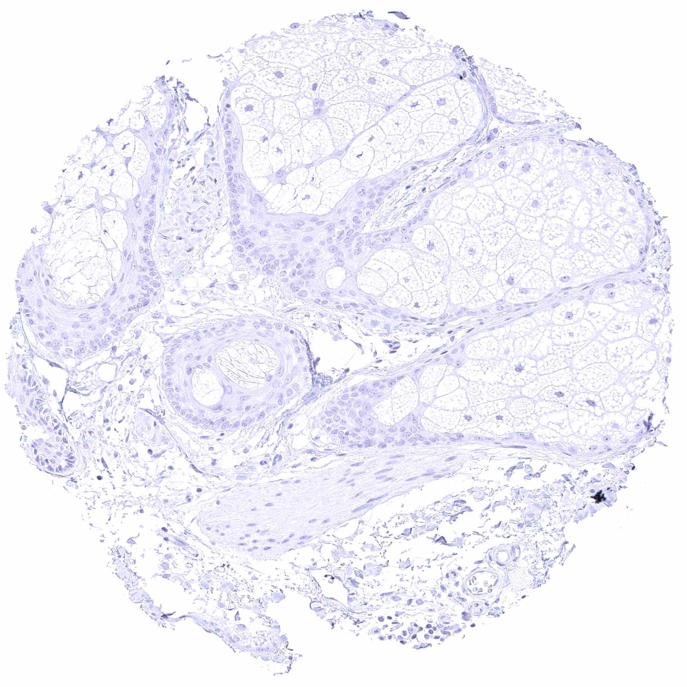 Claudin-6 (MSVA-916R) - MS Validated Antibodies